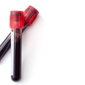 Imunohematologia Eluato – Controllab