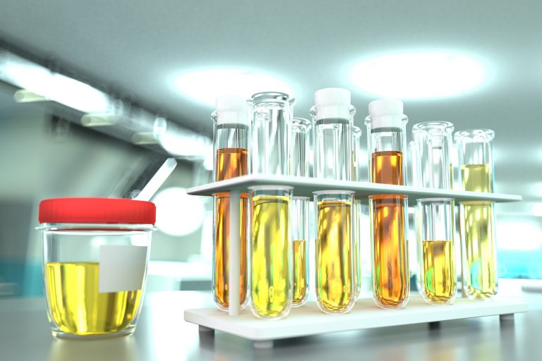 Ácidos Orgânicos – Controllab