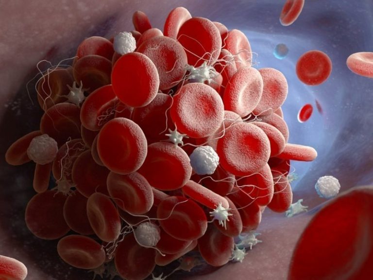 Coagulação e Hemostasia – Controllab